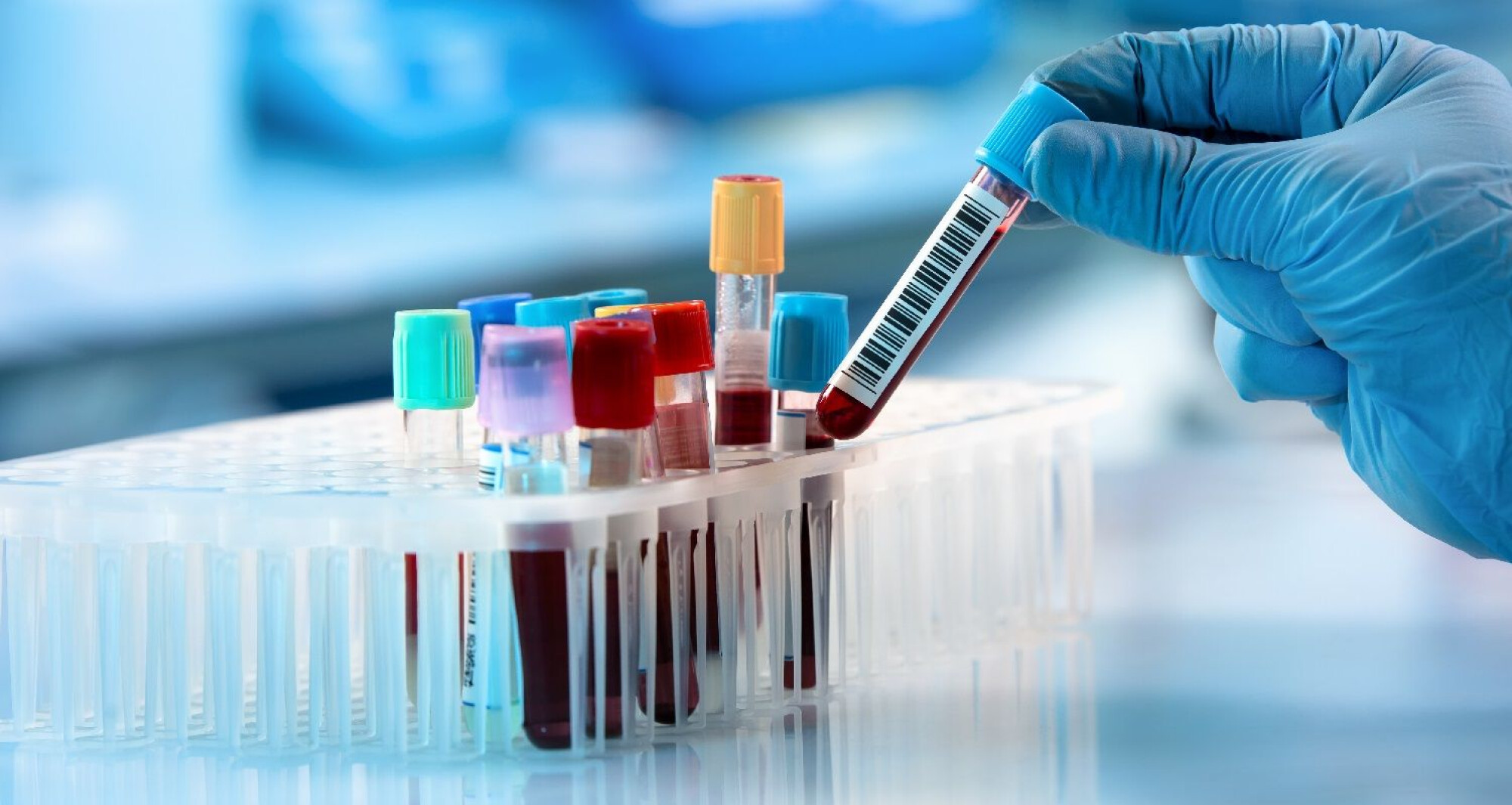 Analize pentru FIV | Centrul FIV SANADOR